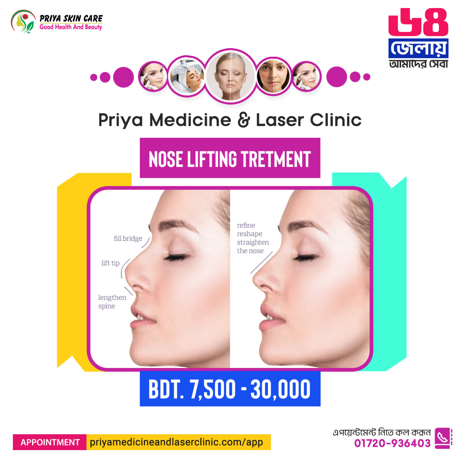 Nose Lifting Treatment – Priya Medicine and Laser Clinic